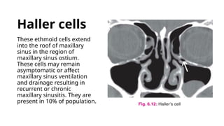 ANATOMY AND DEVELOPMENT OF PARANASAL SINUSES 2.pptx