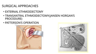 ANATOMY AND DEVELOPMENT OF PARANASAL SINUSES 2.pptx