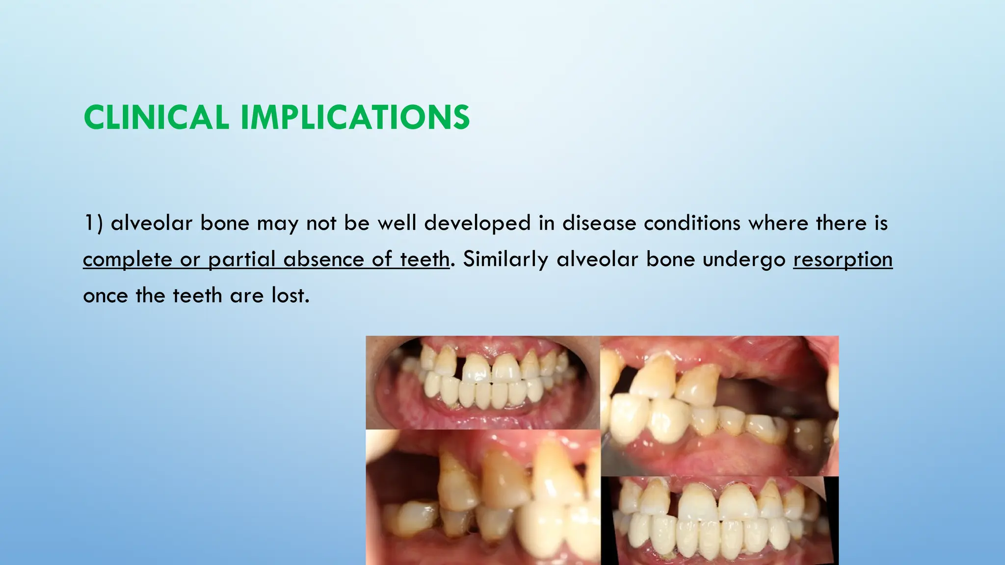 anatomy and development of periodontal tissues.pptx