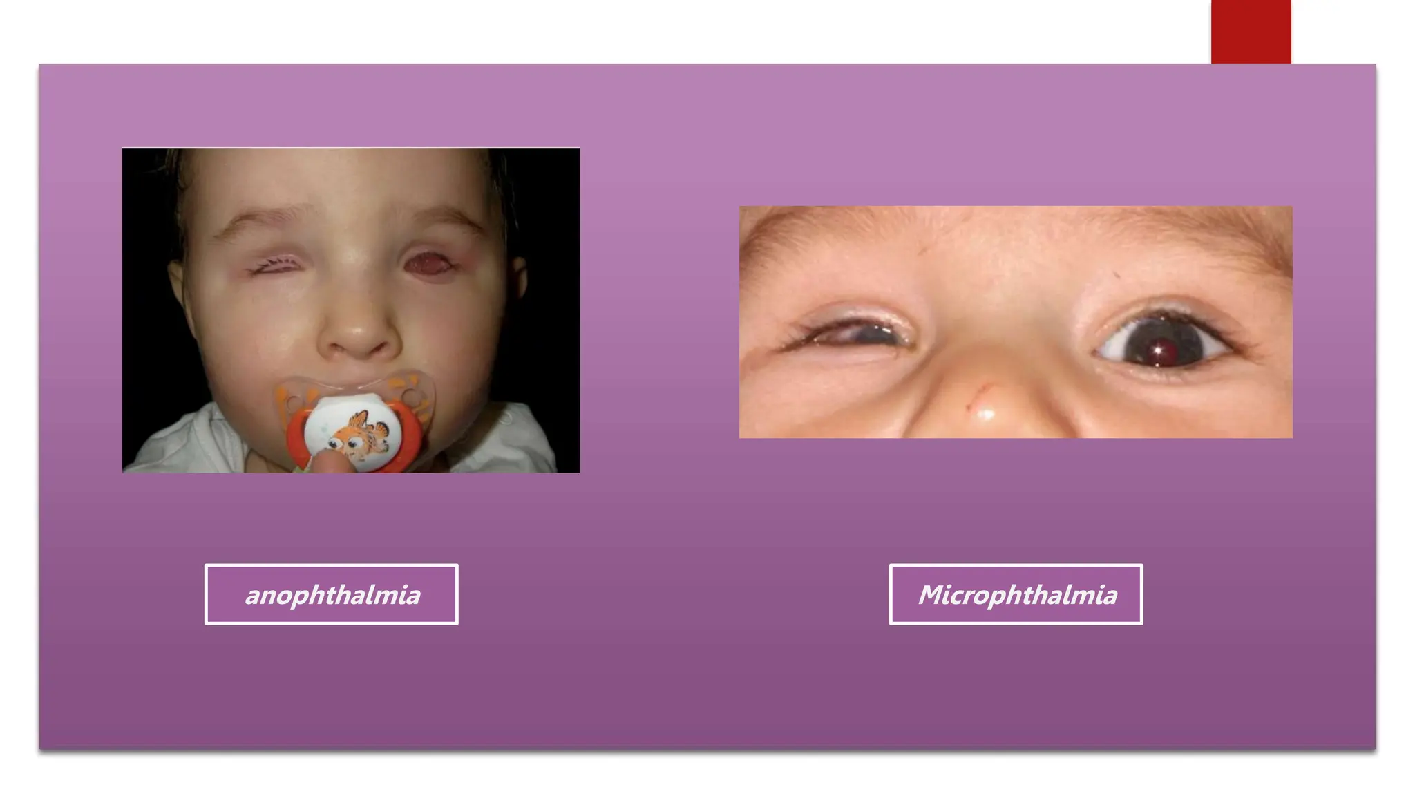 ANATOMY AND DEVELOPMENT OF THE HUMAN EYE. | PPTX