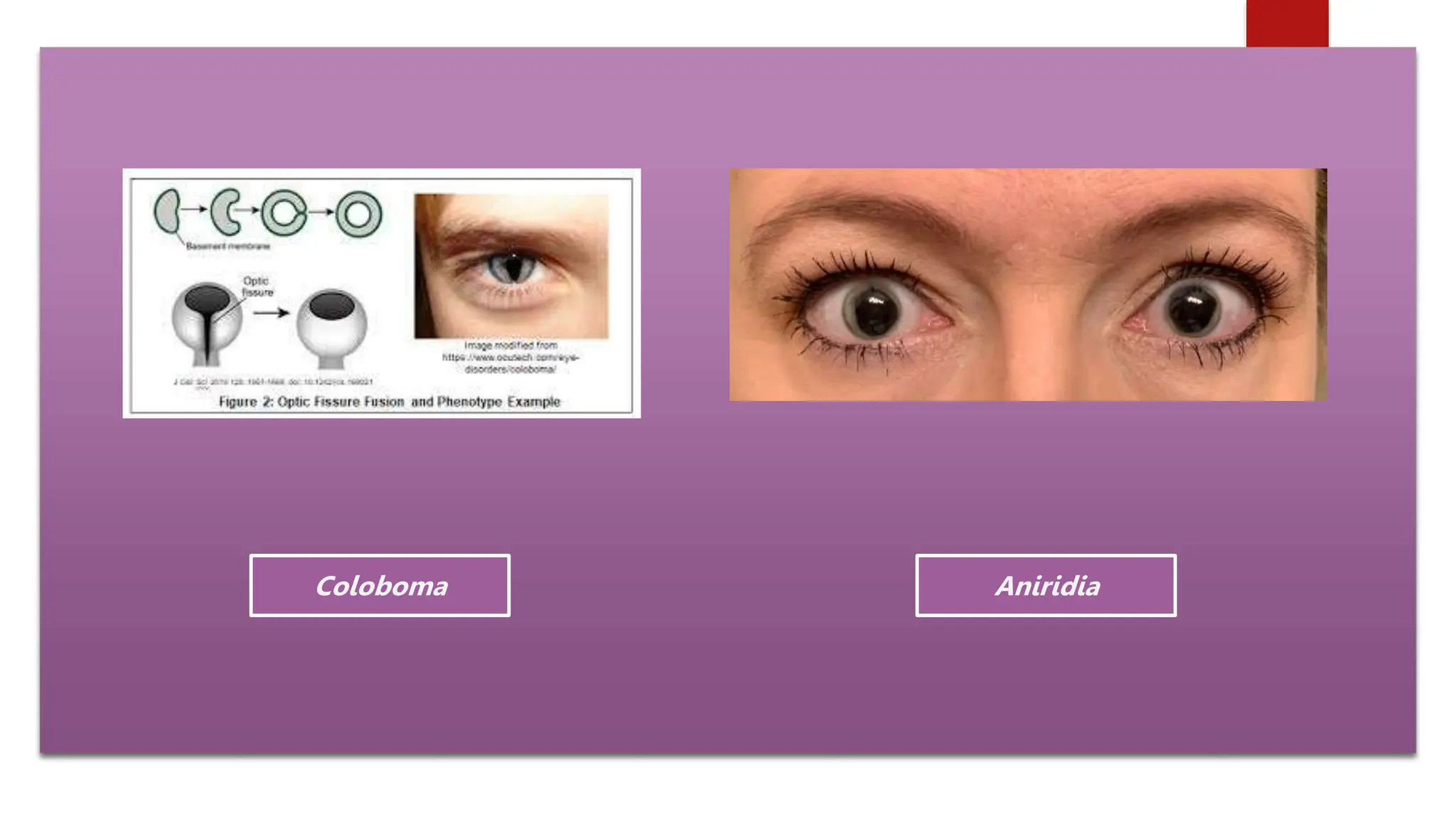 ANATOMY AND DEVELOPMENT OF THE HUMAN EYE. | PPTX