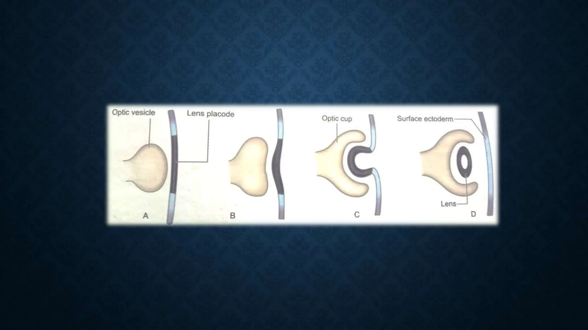 ANATOMY AND DEVELOPMENT OF THE HUMAN EYE. | PPTX