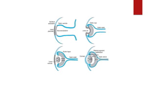 ANATOMY AND DEVELOPMENT OF THE HUMAN EYE. | PPT