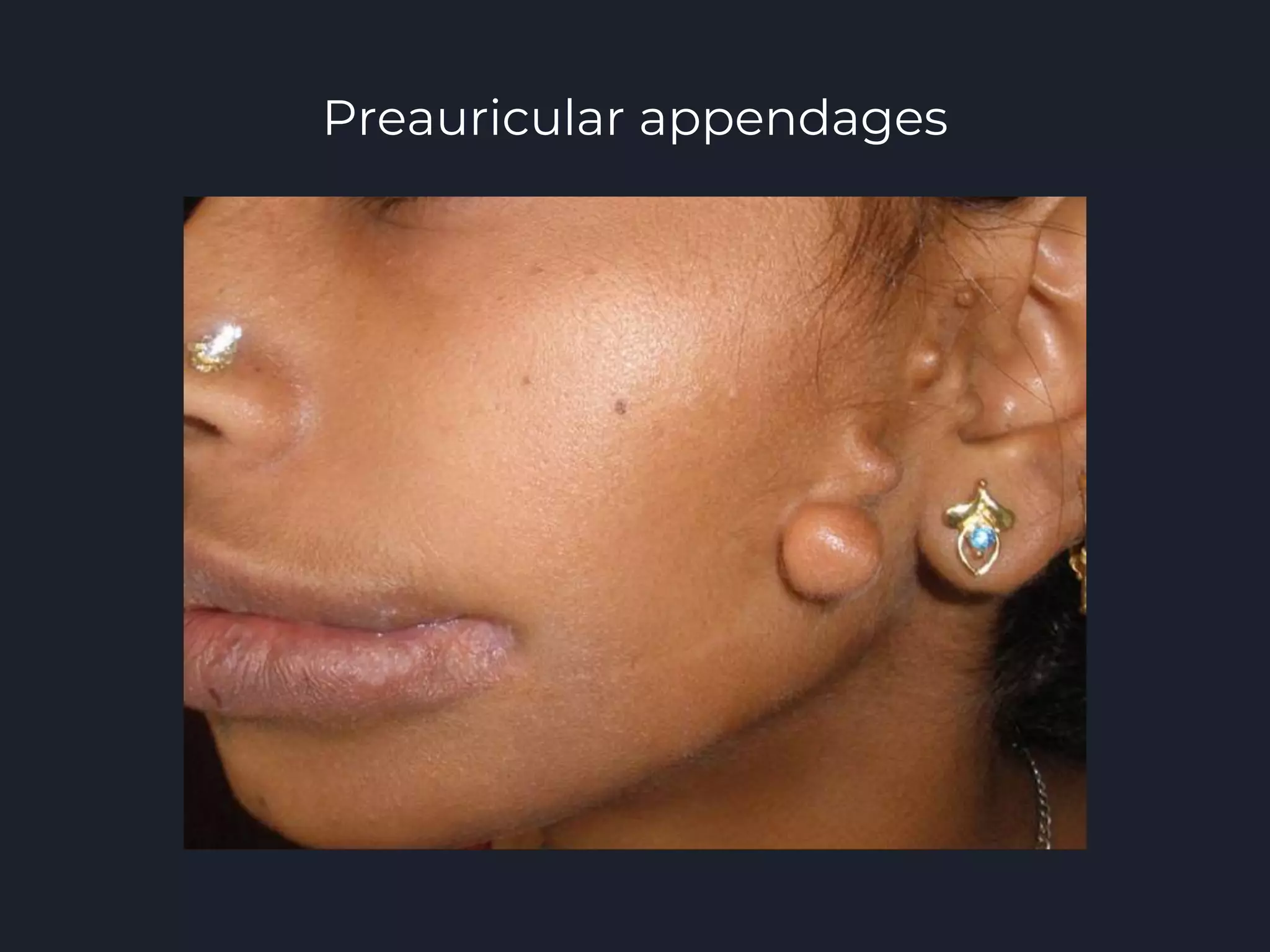 anatomy and disease of ext ear.pptx