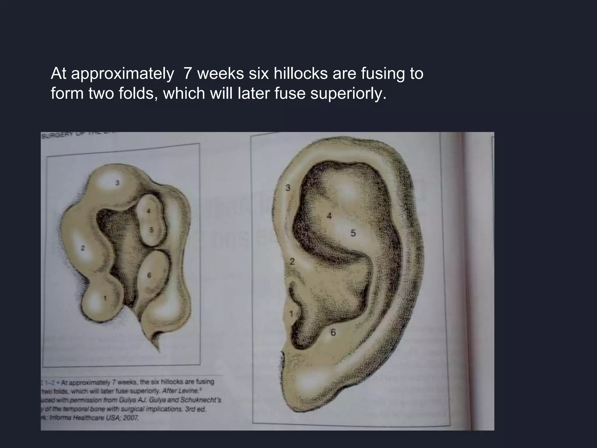 anatomy and disease of ext ear.pptx