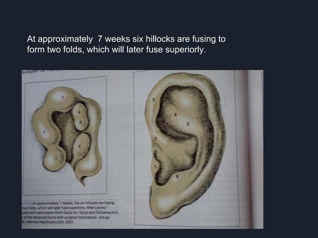 anatomy and disease of ext ear.pptx