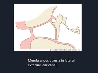 anatomy and disease of ext ear.pptx