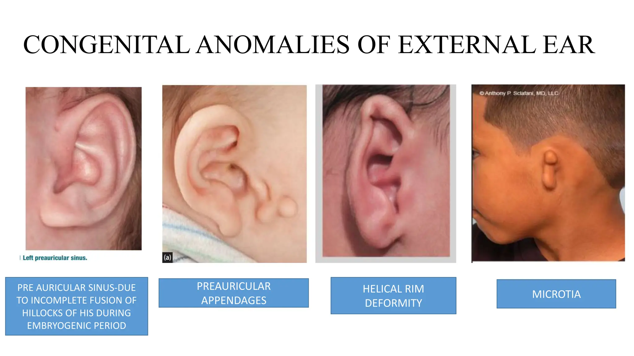 Anatomy and Embryology of External Ear.pptx