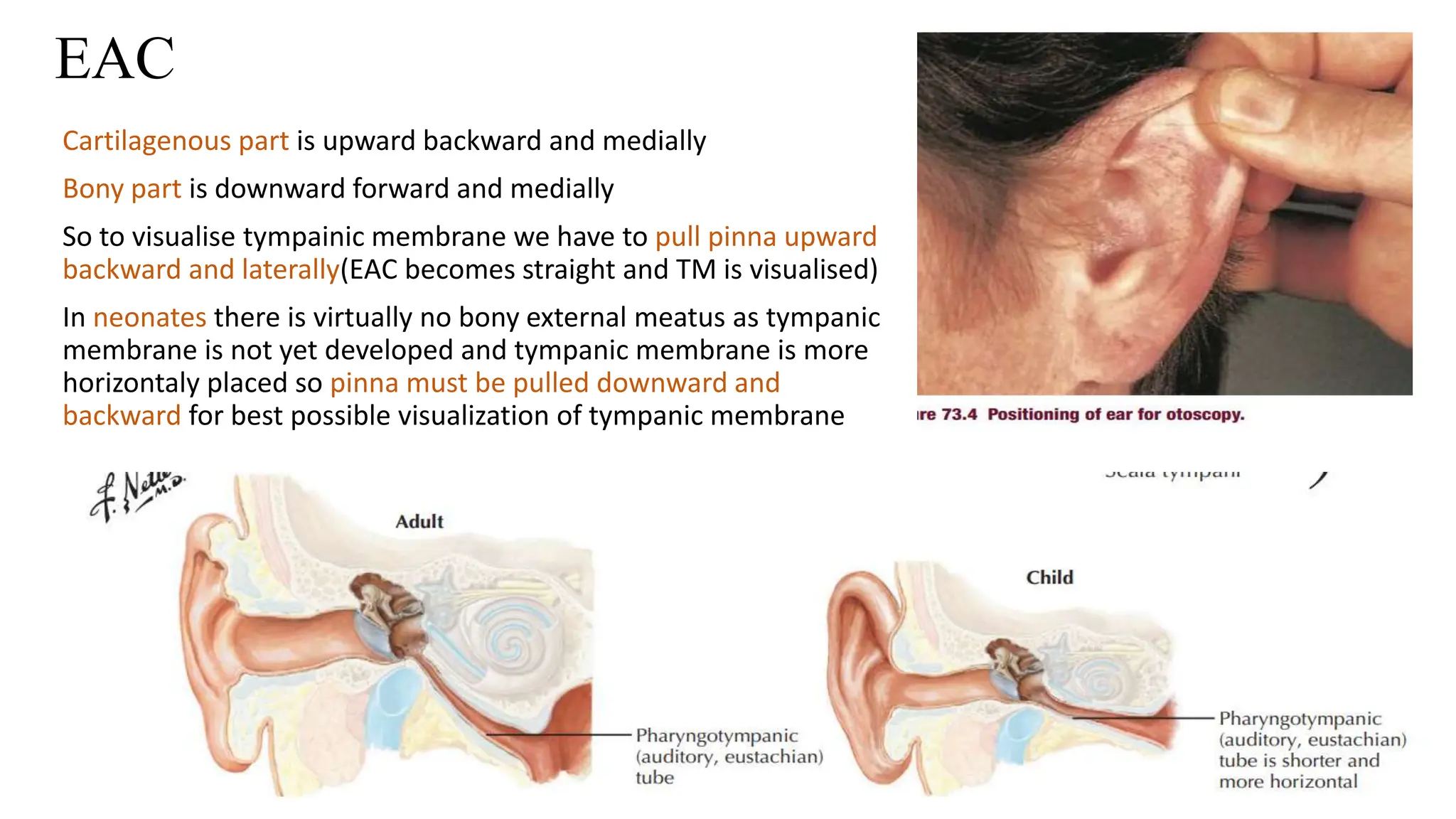Anatomy and Embryology of External Ear.pptx