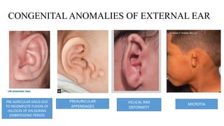 Anatomy and Embryology of External Ear.pptx