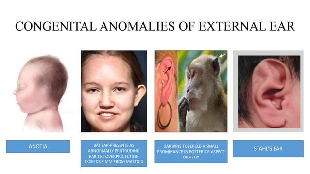 Anatomy and Embryology of External Ear.pptx