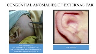 Anatomy and Embryology of External Ear.pptx