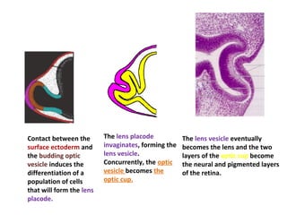 Anatomy and embryology of the eye 2011 | PPT