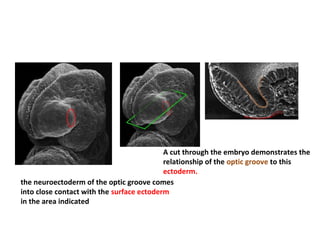 Anatomy and embryology of the eye 2011 | PPT