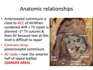 Anatomy and embryology of valves | PPTX