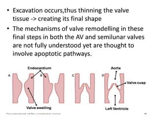 Anatomy and embryology of valves | PPTX