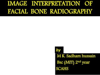 Anatomy and image interpretation of facial bone | PPTX