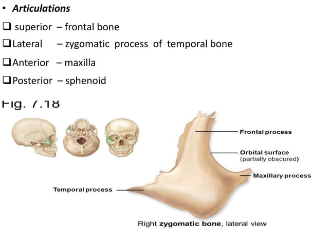 Anatomy and image interpretation of facial bone | PPTX | Death, Injury ...