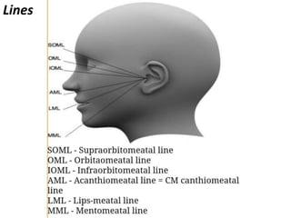 Anatomy and image interpretation of facial bone | PPTX