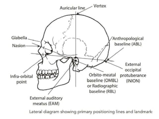 Anatomy and image interpretation of facial bone | PPTX