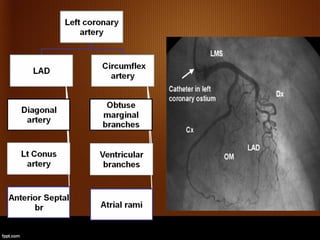 Anatomy and imaging of coronary artery disease with | PPT