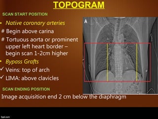 Anatomy and imaging of coronary artery disease with | PPT