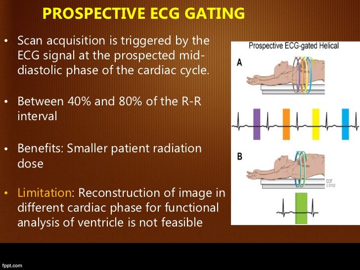 Anatomy and imaging of coronary artery disease with