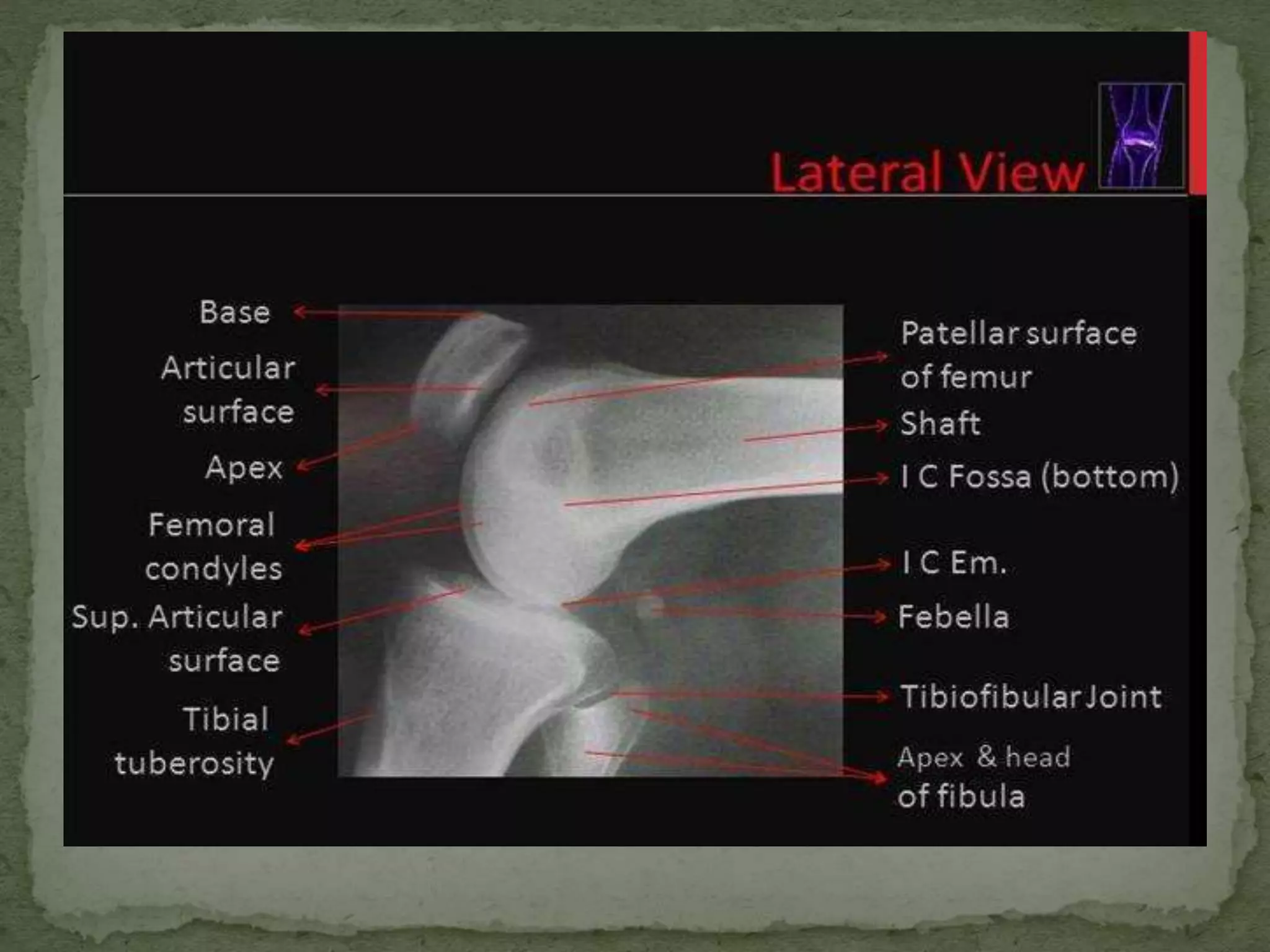 Anatomy and imaging of knee joint | PPTX