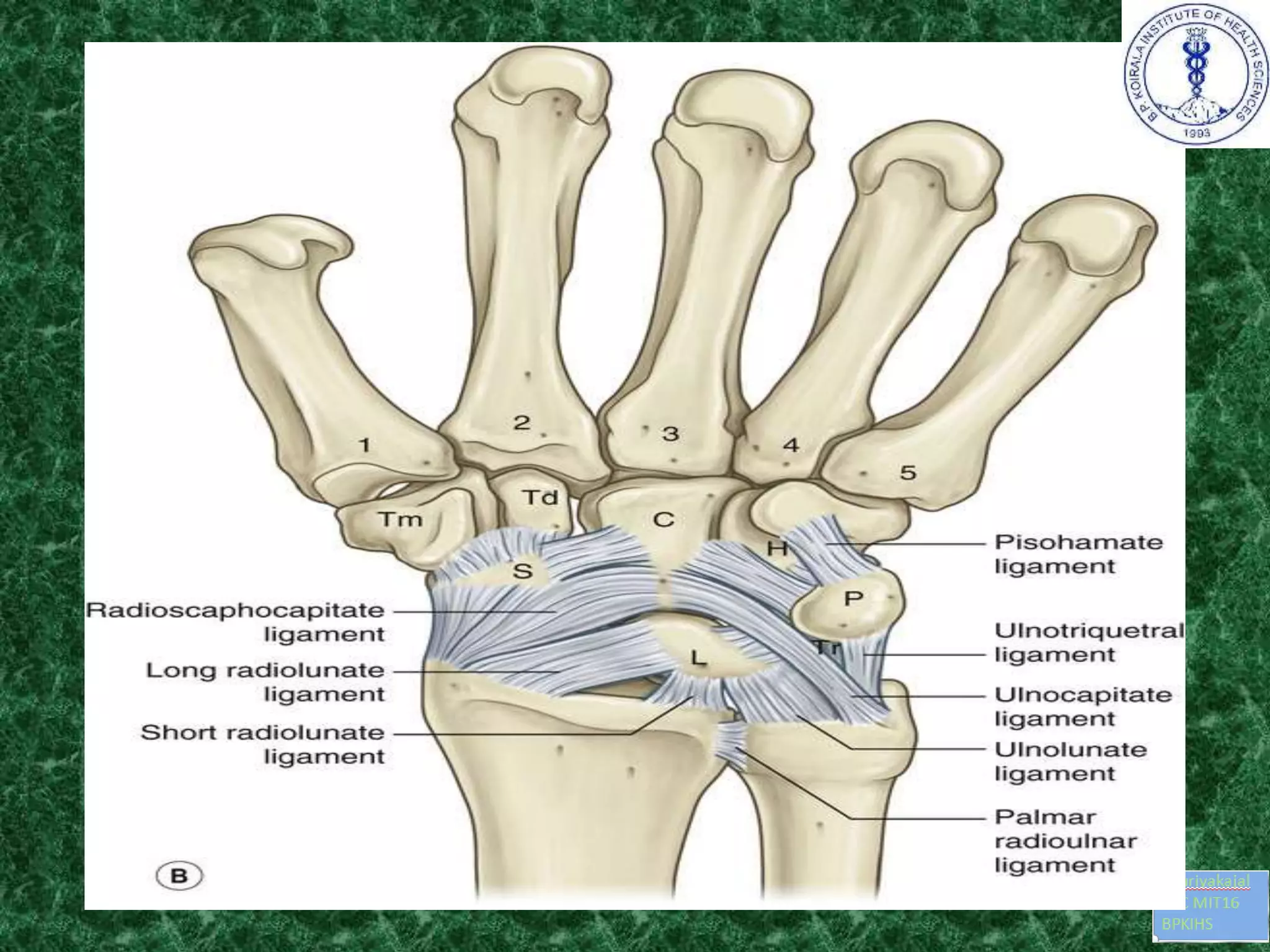 Anatomy and imaging of wrist joint (MRI AND XRAY) | PPTX