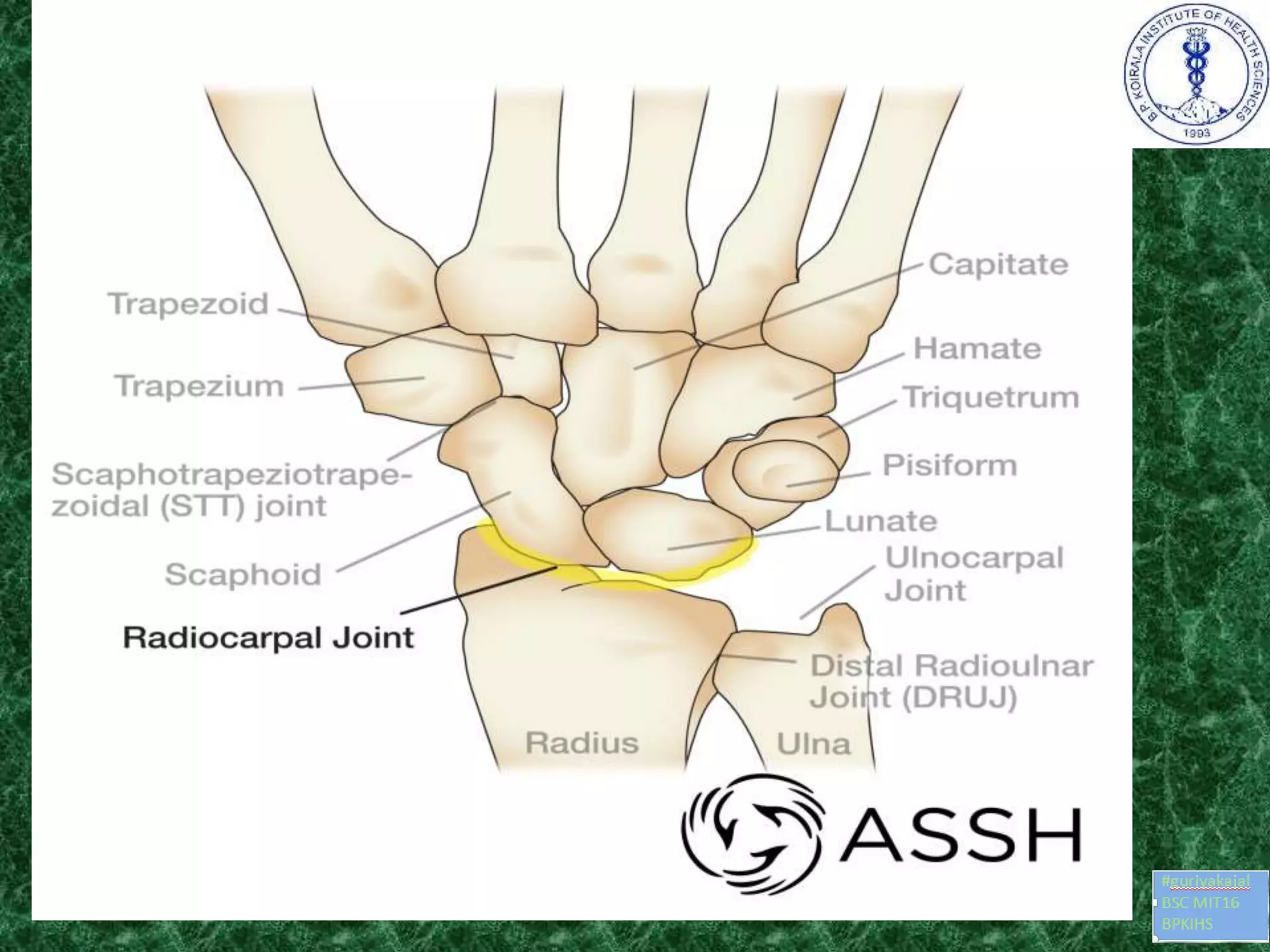Anatomy and imaging of wrist joint (MRI AND XRAY) | PPTX