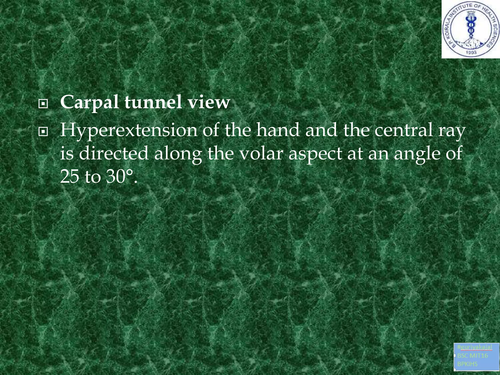 Anatomy and imaging of wrist joint (MRI AND XRAY) | PPTX