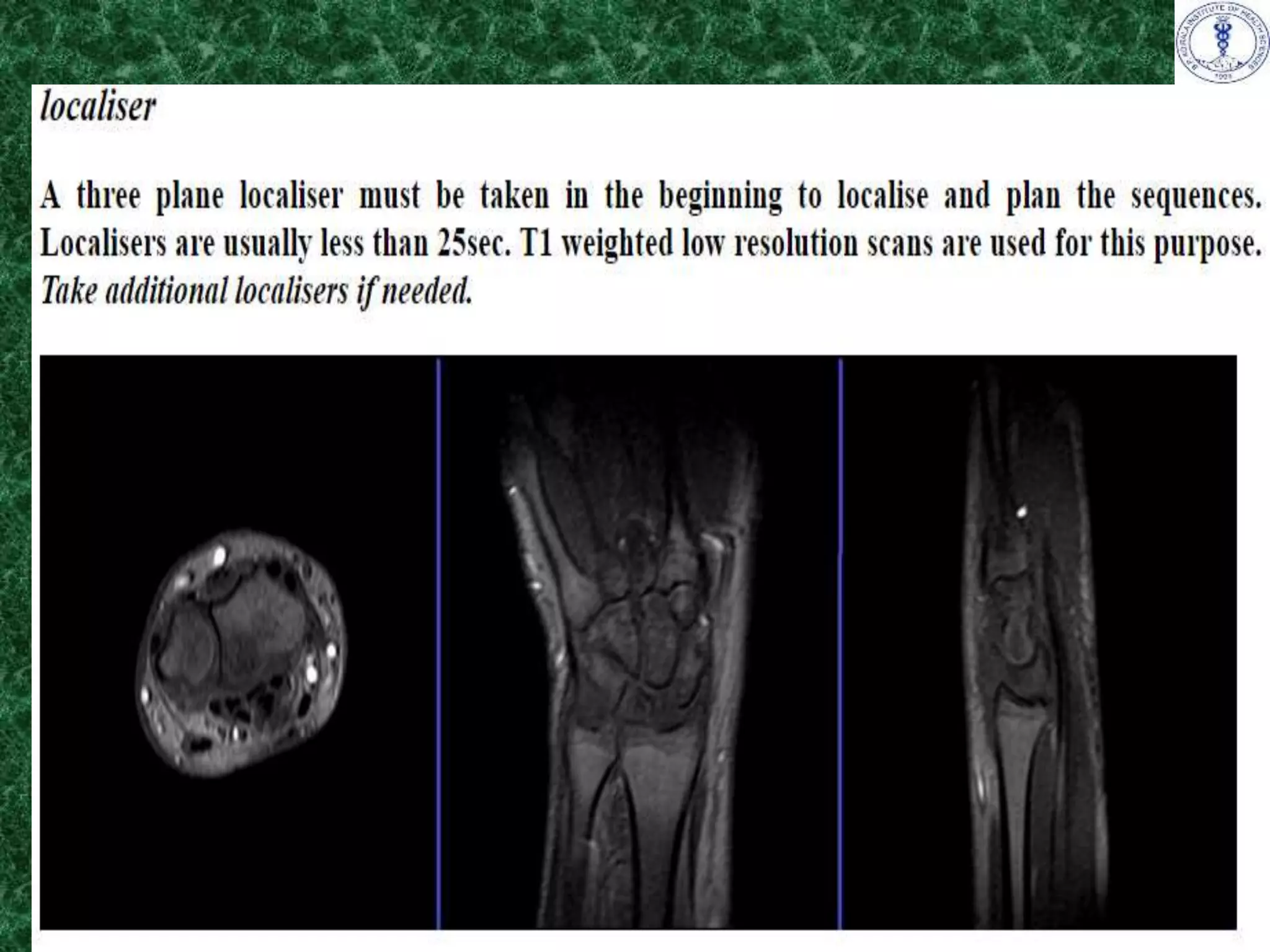 Anatomy and imaging of wrist joint (MRI AND XRAY) | PPTX