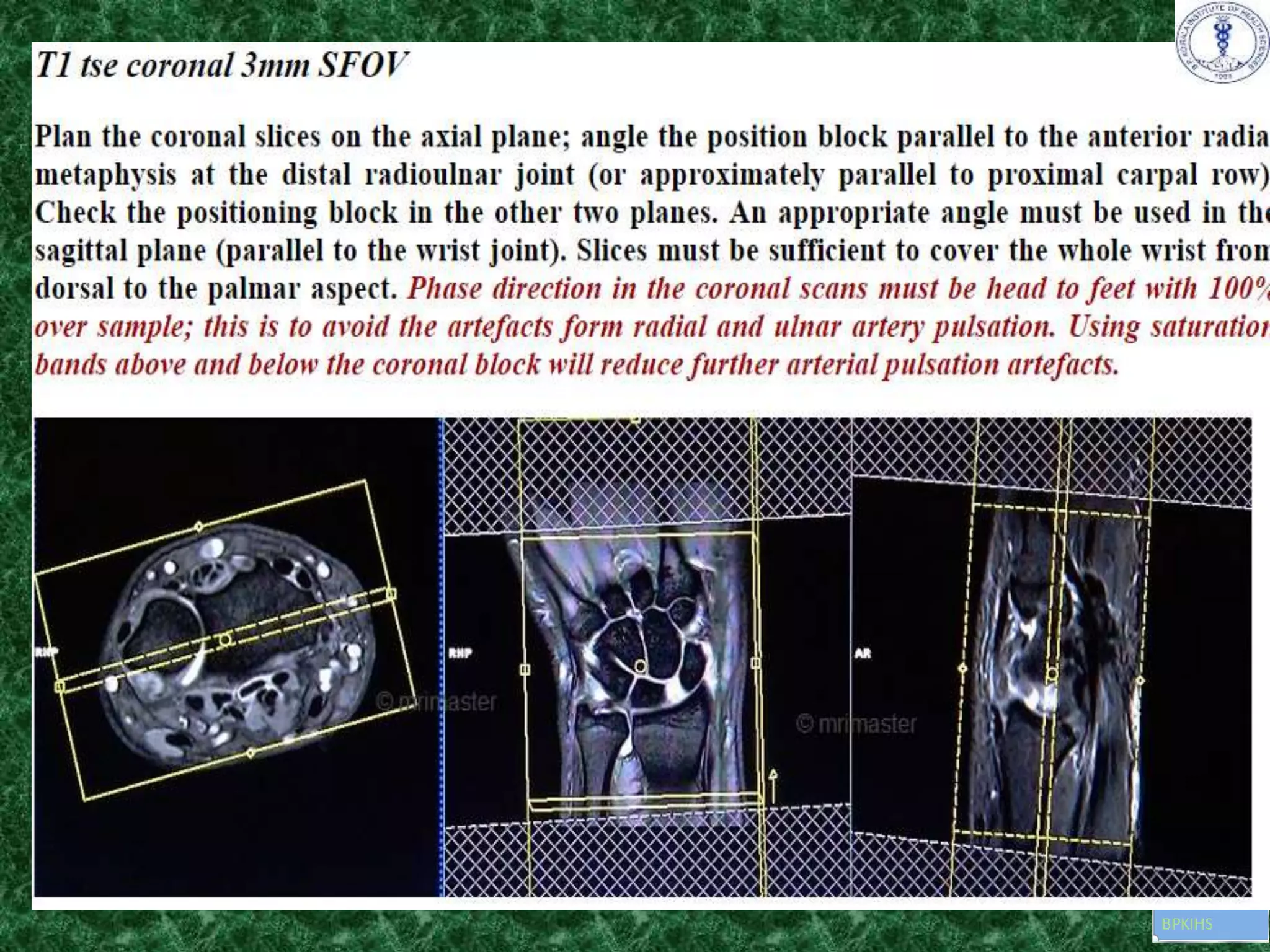 Anatomy and imaging of wrist joint (MRI AND XRAY) | PPTX