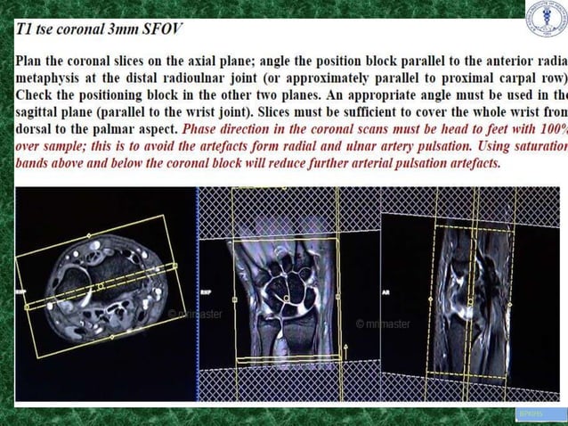 Anatomy and imaging of wrist joint (MRI AND XRAY) | PPTX