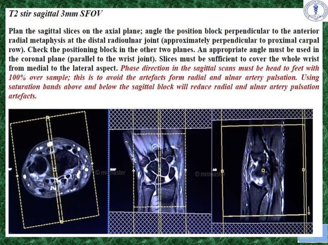 Anatomy and imaging of wrist joint (MRI AND XRAY) | PPTX