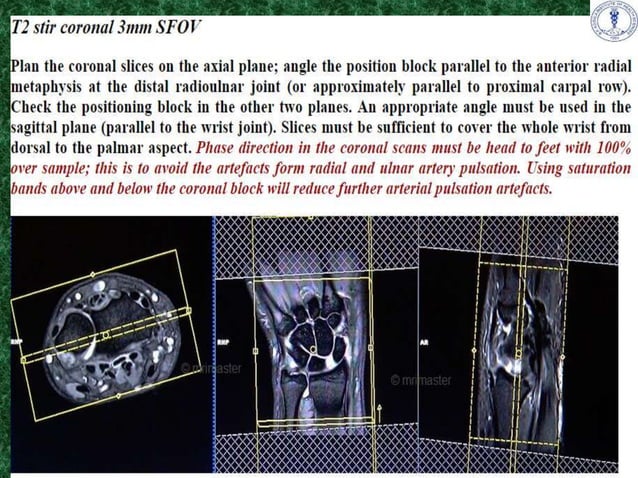 Anatomy and imaging of wrist joint (MRI AND XRAY) | PPTX