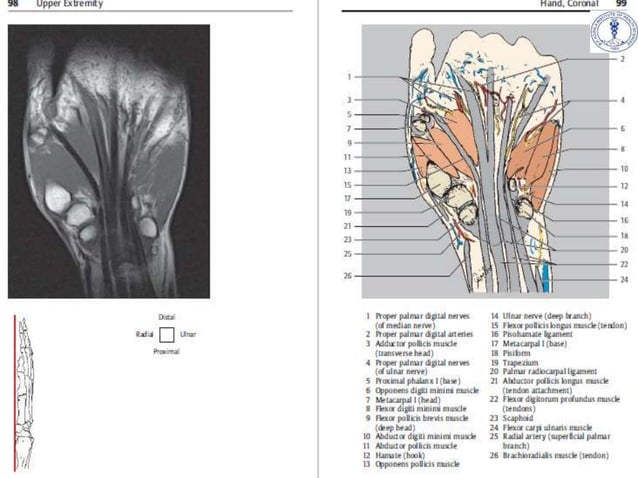 Anatomy and imaging of wrist joint (MRI AND XRAY) | PPTX