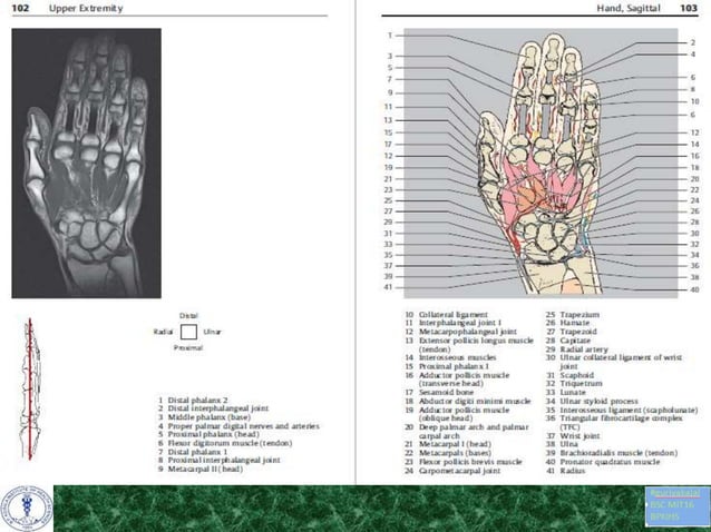 Anatomy and imaging of wrist joint (MRI AND XRAY) | PPTX