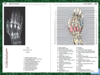 Anatomy and imaging of wrist joint (MRI AND XRAY) | PPTX