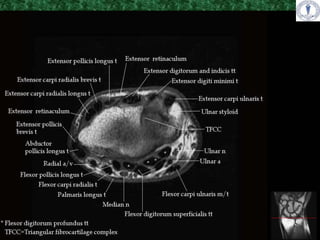 Anatomy and imaging of wrist joint (MRI AND XRAY) | PPTX
