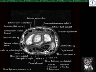 Anatomy and imaging of wrist joint (MRI AND XRAY) | PPTX