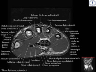 Anatomy and imaging of wrist joint (MRI AND XRAY) | PPTX