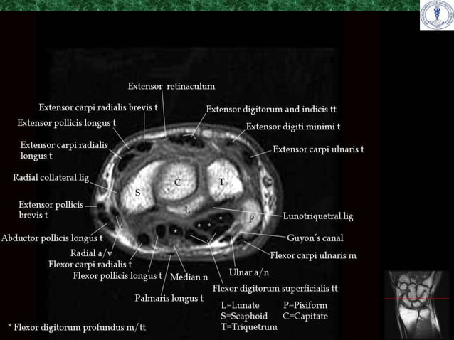 Anatomy and imaging of wrist joint (MRI AND XRAY)