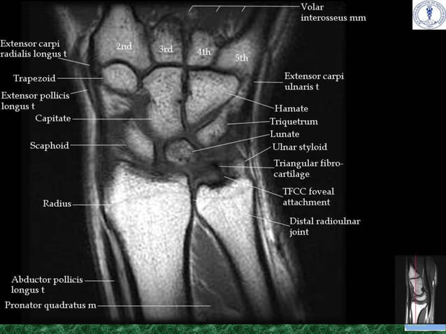 Anatomy and imaging of wrist joint (MRI AND XRAY)