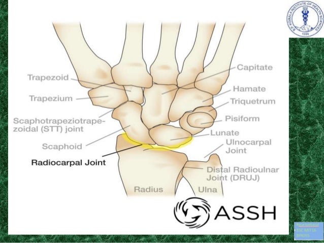 Anatomy and imaging of wrist joint (MRI AND XRAY)