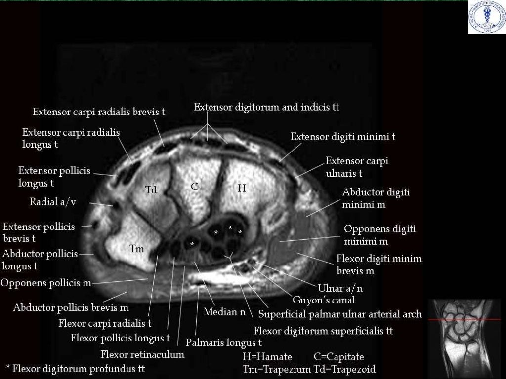Anatomy and imaging of wrist joint (MRI AND XRAY)