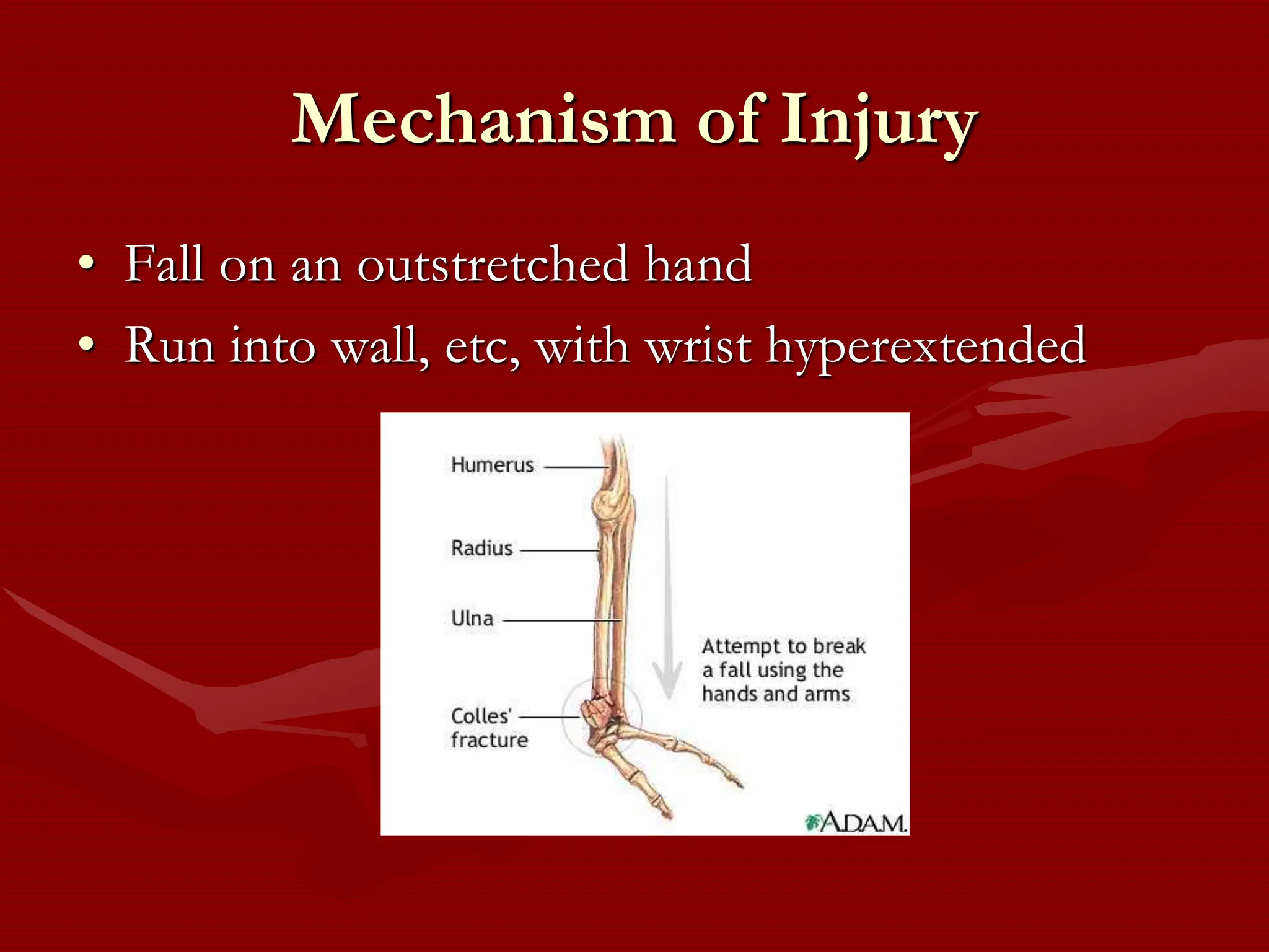 Anatomy and Injuries to the Wrist and Hand.ppt