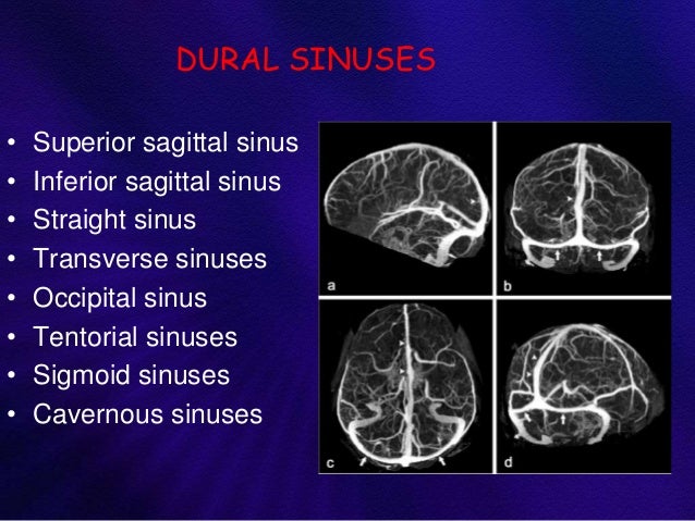 Anatomy and intervention in cerebral vasculature