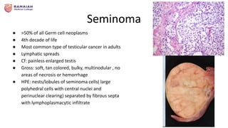 Anatomy,pathology testicular cancers.pdf