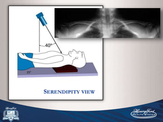 Anatomy and physical exam of the shoulder | PPTX